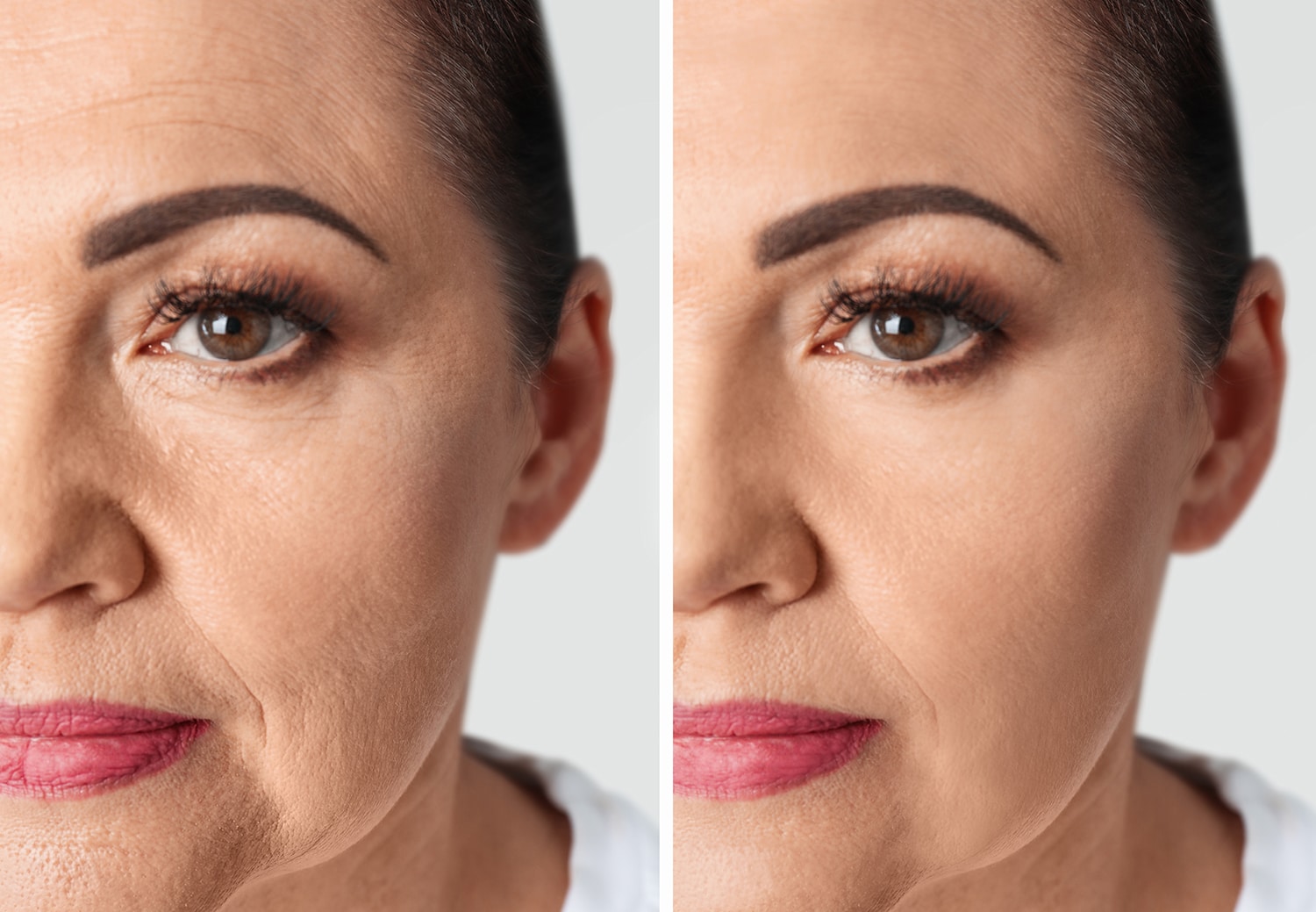 Computer Imaging | Abramson Facial Plastic Surgery